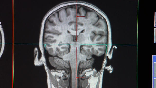 Scientists can use FMRI and computer analysis to read our thoughts - 60 ...