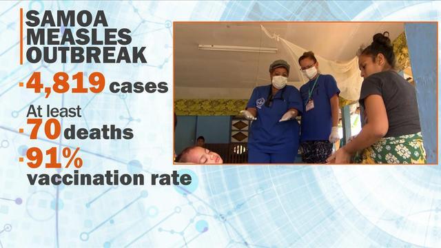 Measles outbreak in Samoa kills 72, most of them children - CBS News