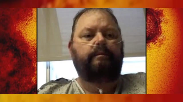 Coronavirus patients describe symptoms: "The fever is so high that you ...