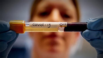 Dr. Jon LaPook on the value of antibody tests for past coronavirus ...