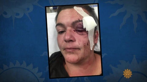 The use of "less-lethal" force by law enforcement - CBS News