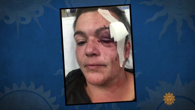 The use of "less-lethal" force by law enforcement - CBS News