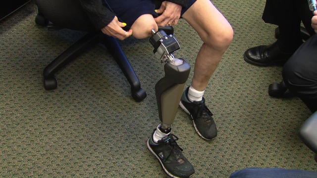 A giant step forward for users of artificial legs - CBS News