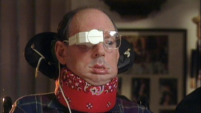 Courageous ALS patients try to live it up - CBS News