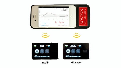 "Bionic pancreas" shows promise for diabetes management - CBS News