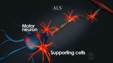 Research making ALS less of a mystery - CBS News