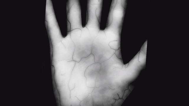 How biometric palm scans help keep hospitals secure - CBS News