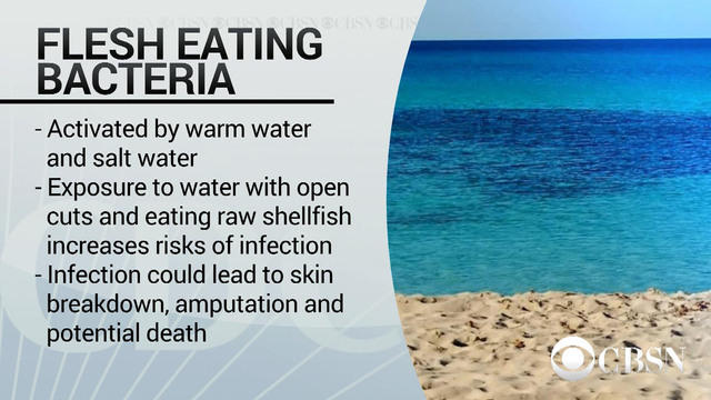 Florida beachgoers warned about deadly flesh-eating bacteria Vibrio ...