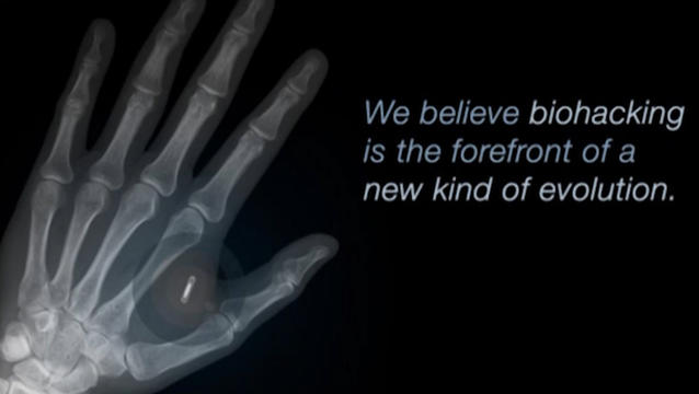 Meet the humans with microchips implanted in them - CBS News