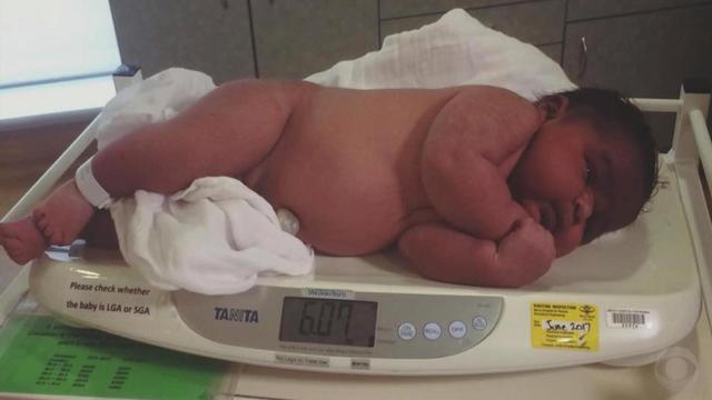 Woman gives birth to 13-pound baby: "I never dreamed he'd be this big ...