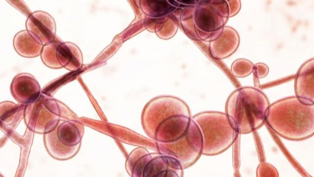 Outbreaks of a drug-resistant superbug fungus spread in two U.S. cities ...