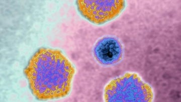 Frozen raspberries recalled due to potential hepatitis A contamination ...