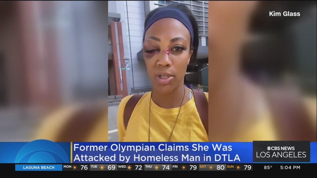 Former Olympian, model Kim Glass attacked by homeless man in Downtown ...