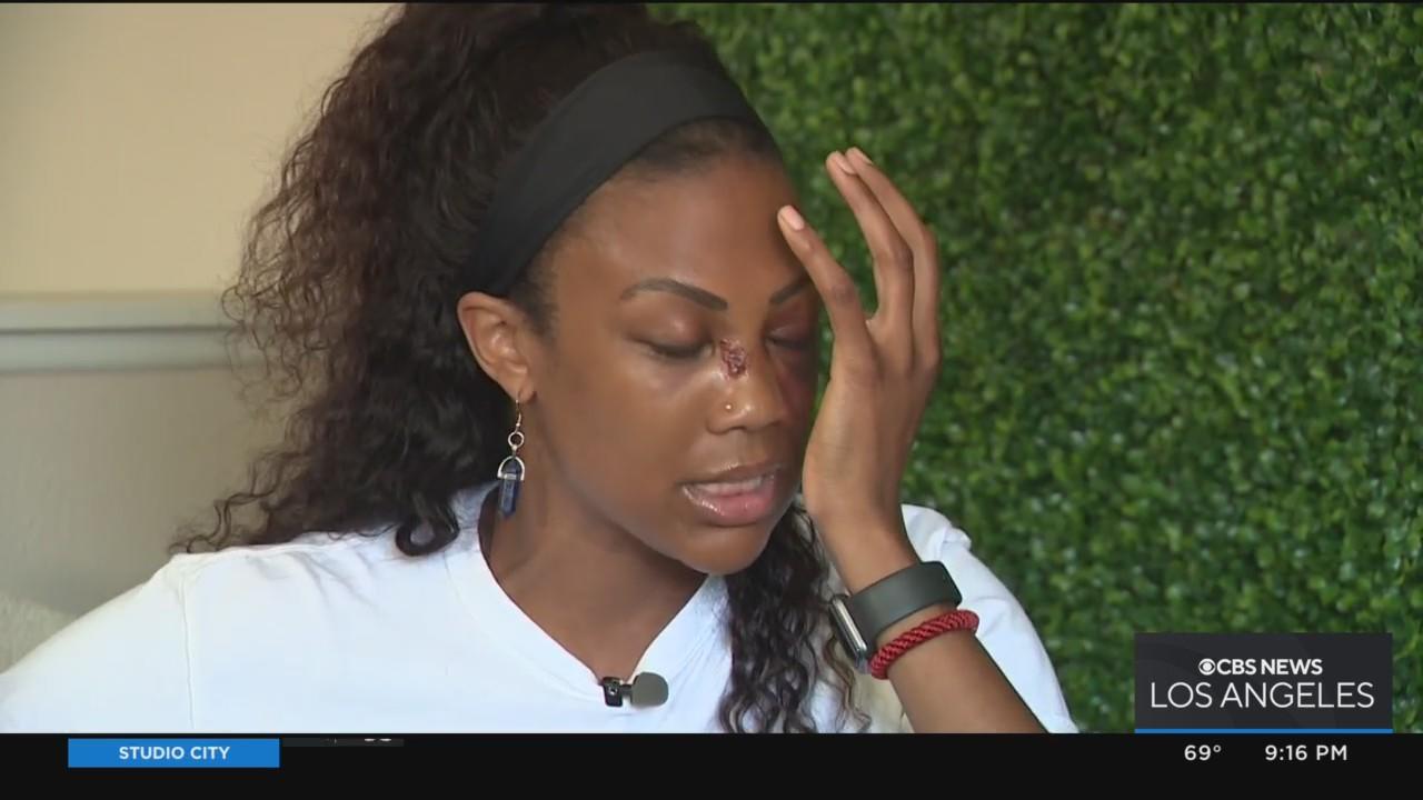 "Rage in his eyes": Former Olympian Kim Glass recovering from attack by ...