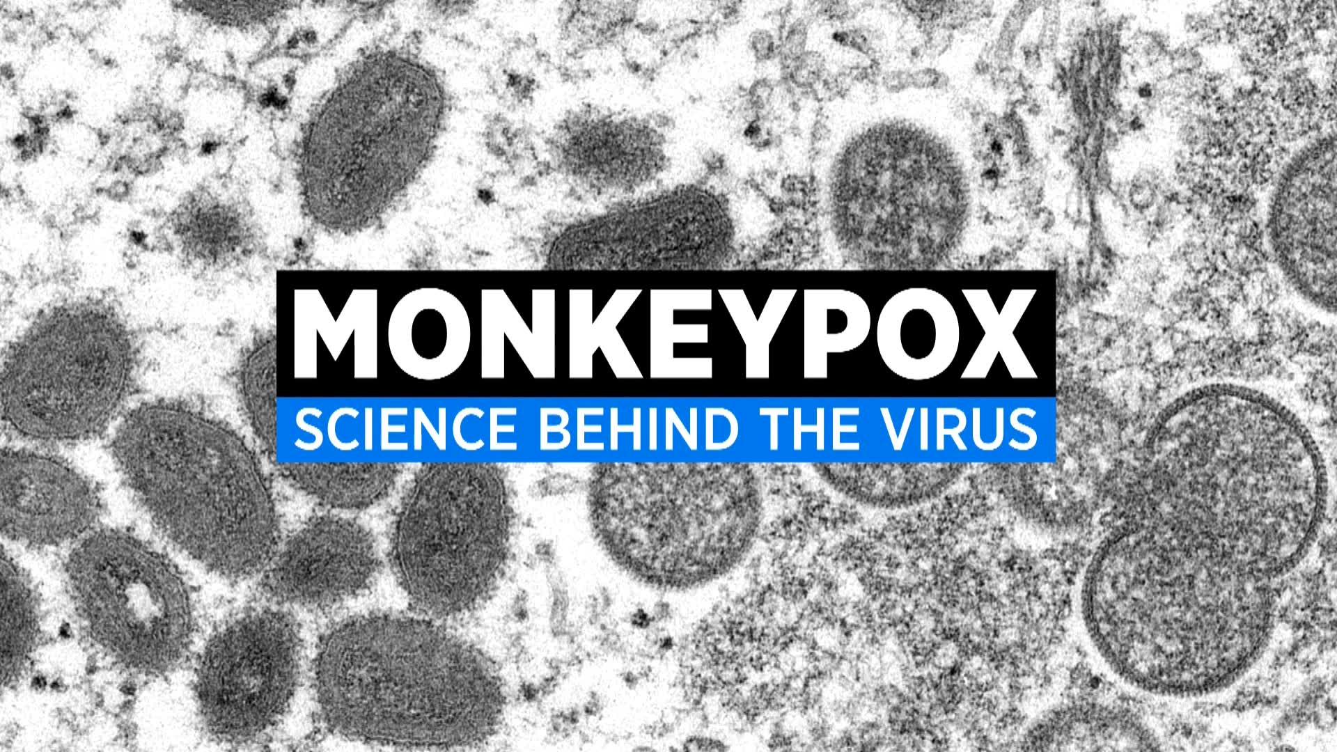 Everything you need to know about monkeypox - CBS Chicago