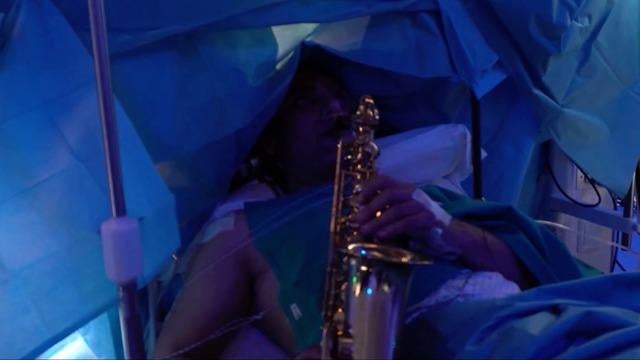 Man plays his saxophone through 9-hour, "very, very complex" brain ...