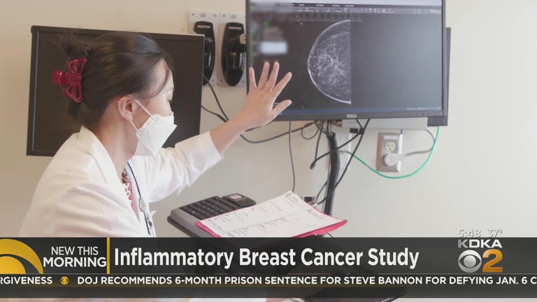 The warning signs of inflammatory breast cancer - CBS Pittsburgh