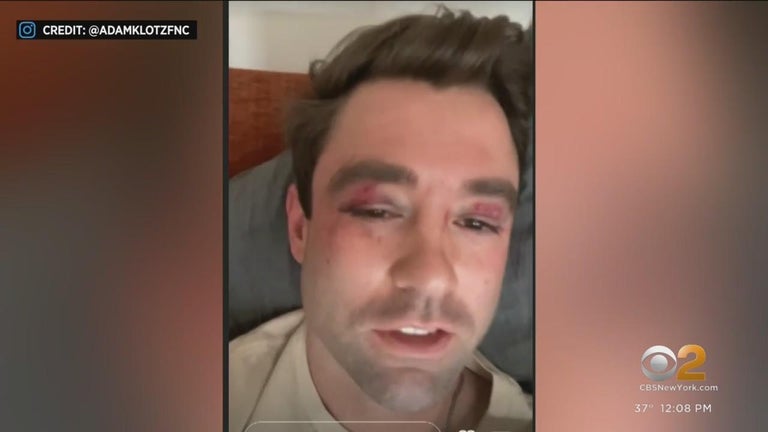Fox News meteorologist Adam Klotz says he was attacked on New York City ...