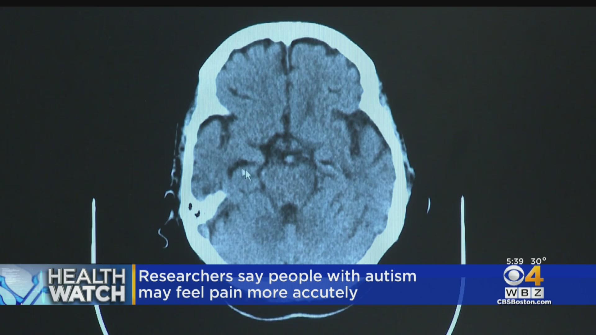 New study reveals people with autism are more sensitive to pain - CBS ...