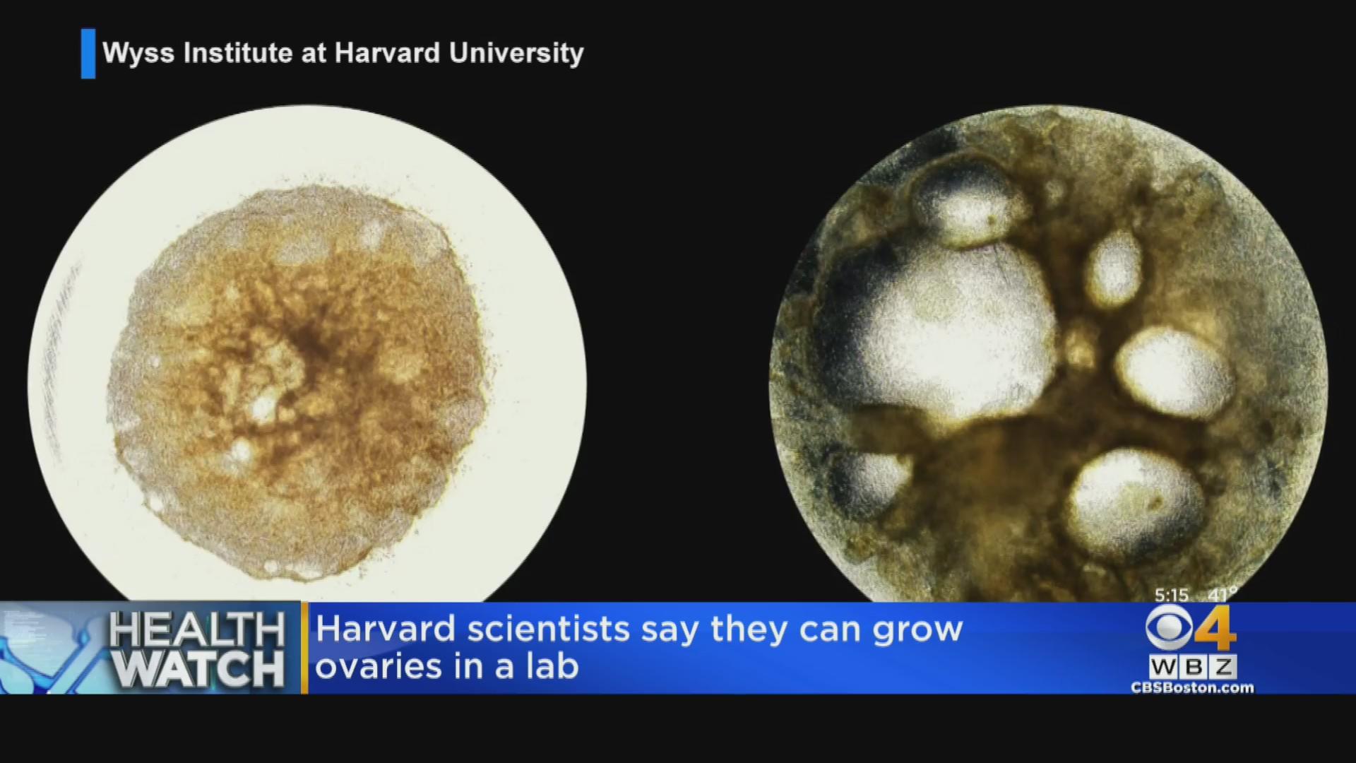 Harvard scientists say they can grow ovaries in a lab - CBS Boston