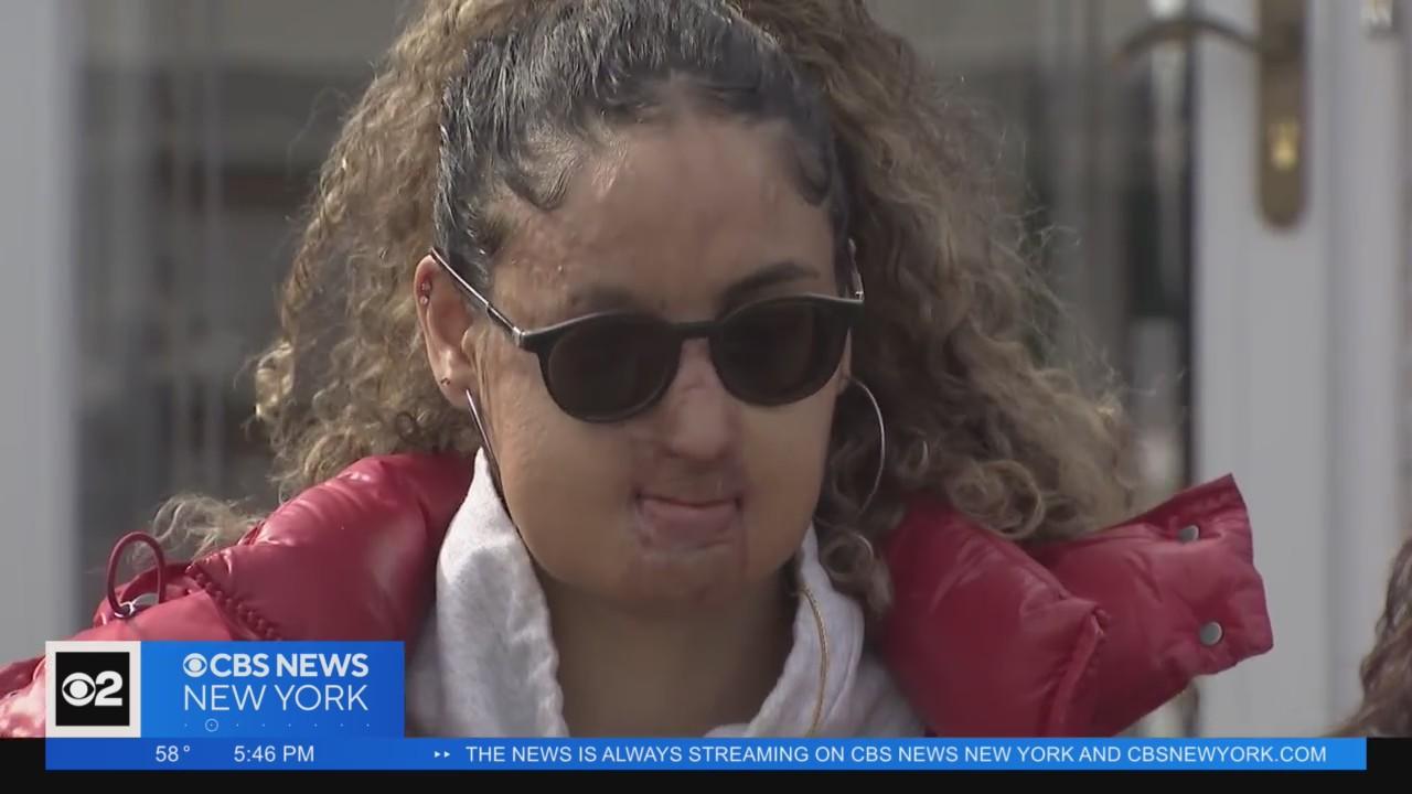 2 years after acid attack, victim Nafiah Ikram pleads for arrest and ...