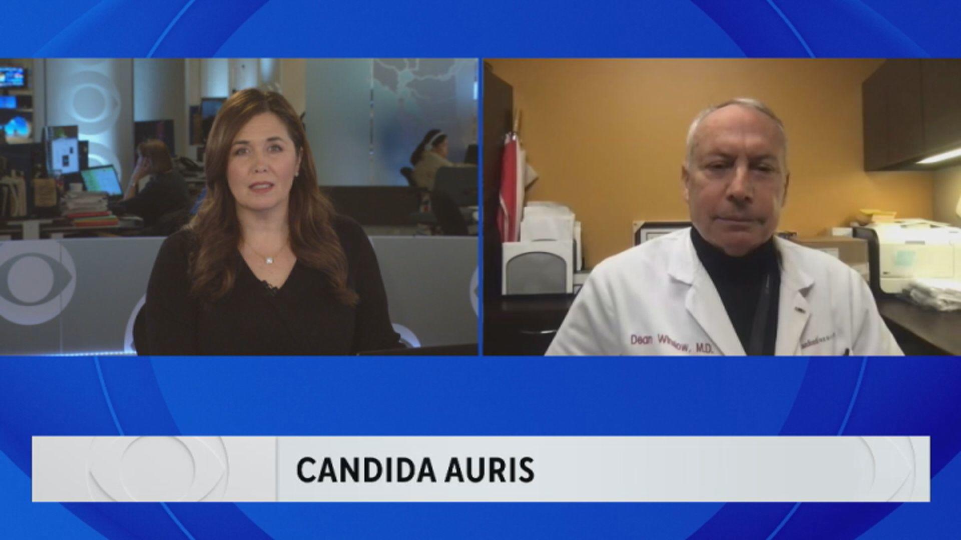 Candida auris: Nevada, California leading nation with most superbug ...