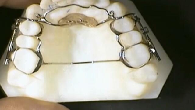 Feds launch criminal investigation into "AGGA" dental device and its ...