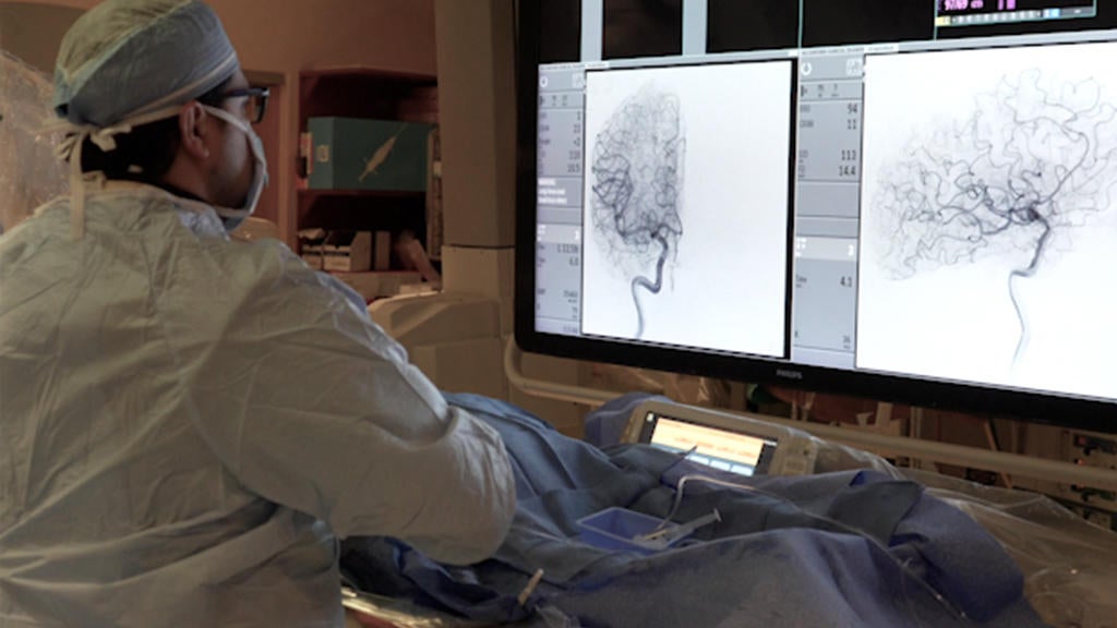 Artificial Intelligence Is Leading To Faster Stroke Diagnosis ...