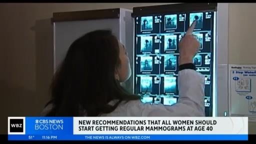 Breast cancer screening mammograms should now start at age 40, says ...