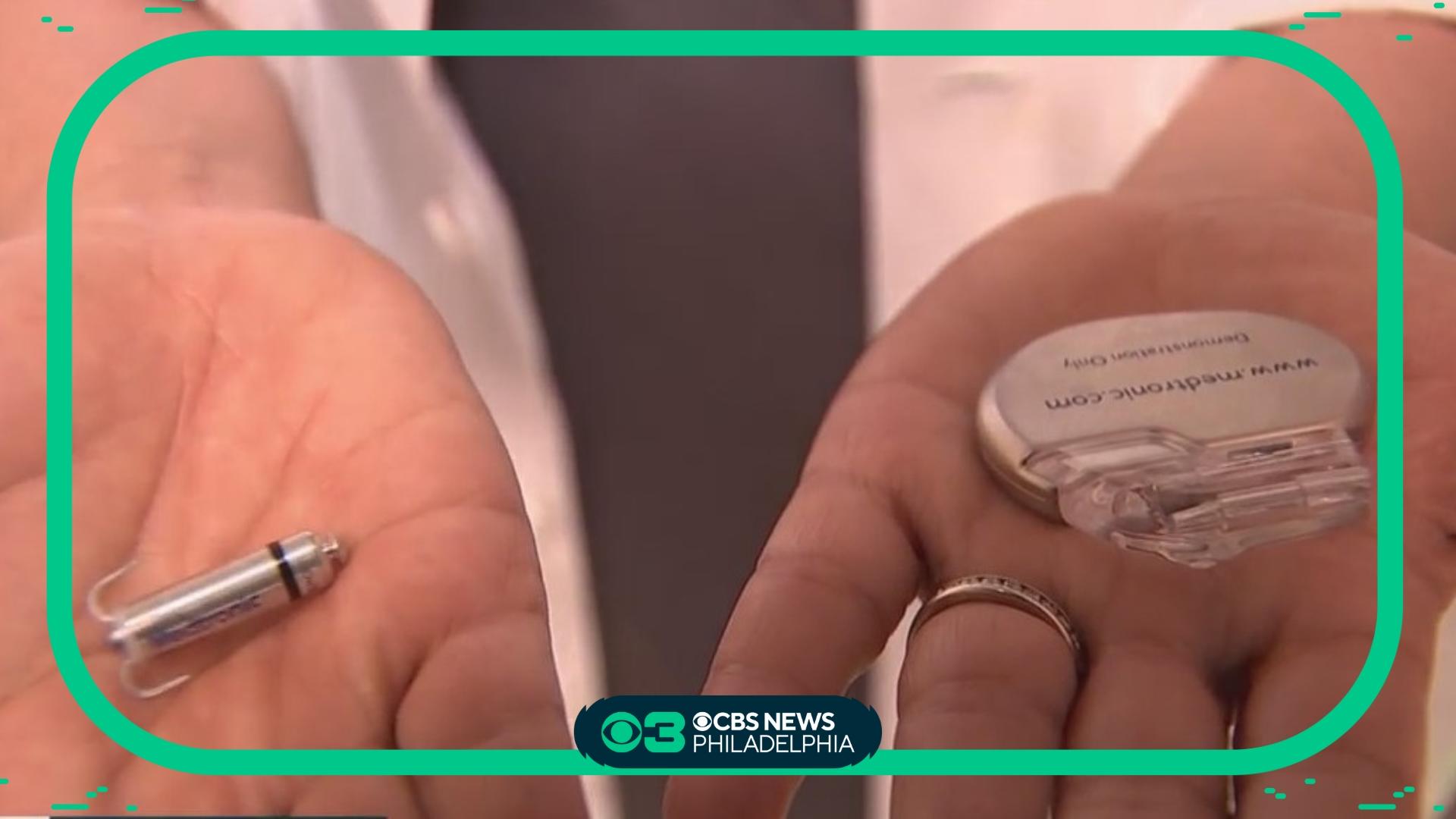 Philadelphia baby receives world's smallest pacemaker - CBS Philadelphia