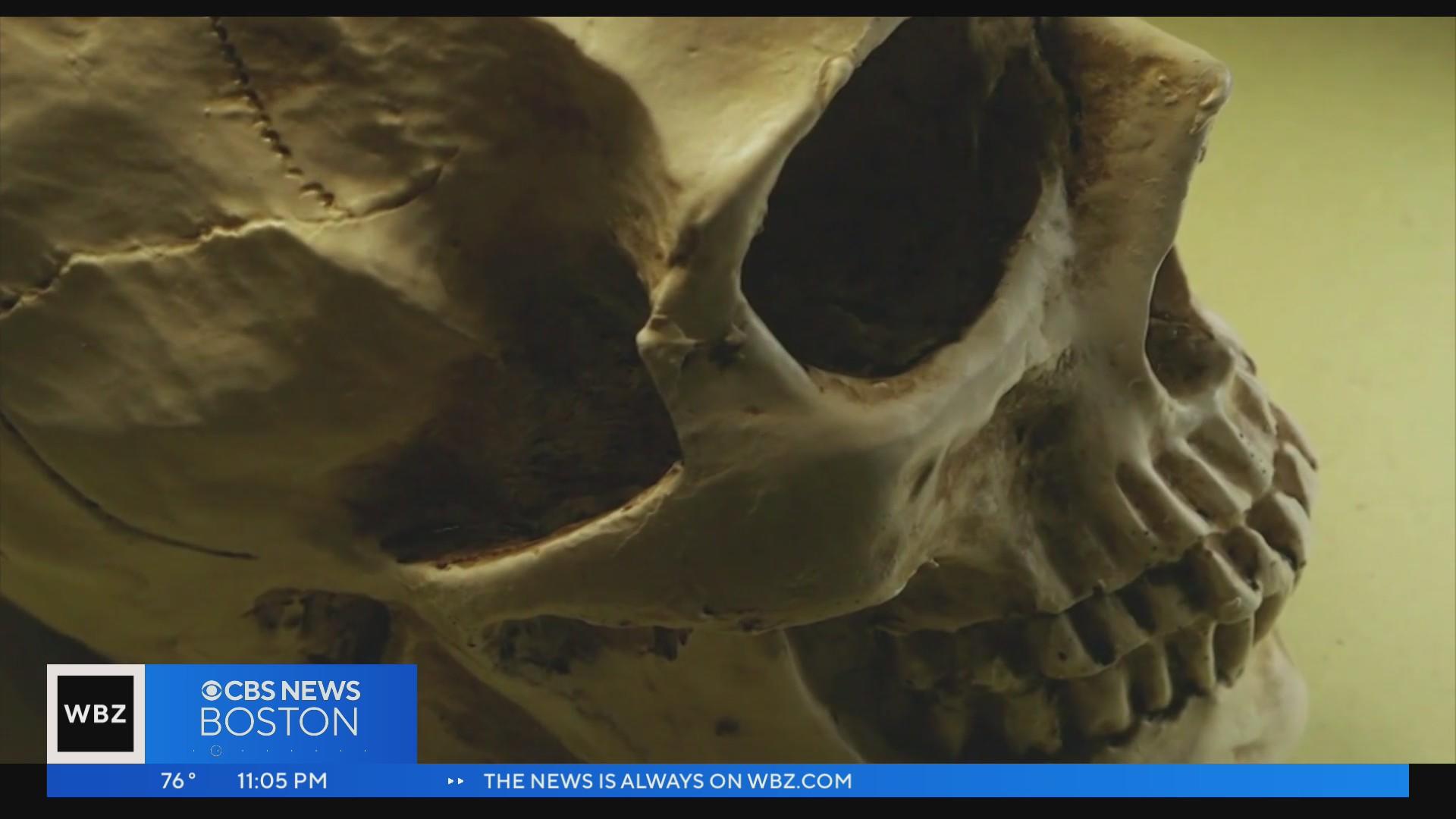 'Sets back the medical industry': Legitimate bone collector condemns ...