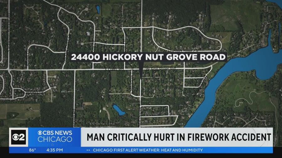Man critically injured in fireworks accident in Cary - CBS Chicago