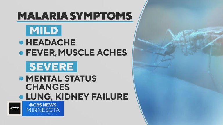 How concerned should Minnesotans be about malaria's spread? - CBS Minnesota