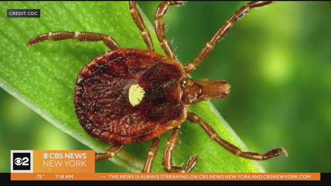 On Call with Dr. Nidhi Kumar: Tick safety - CBS New York