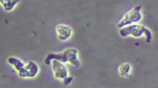 Georgia resident dies from rare brain-eating amoeba, "likely infected ...