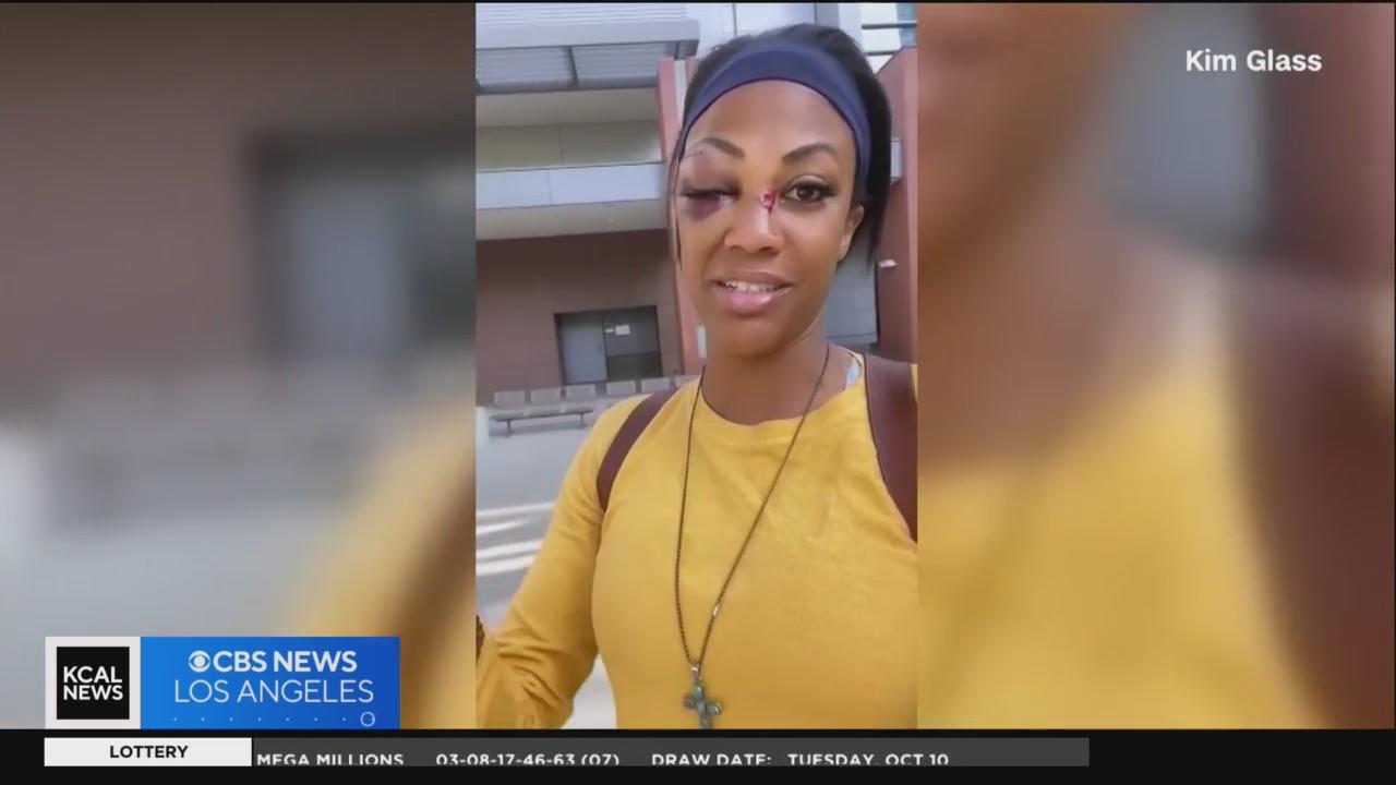 "It's like a little slap in the face;" Olympian Kim Glass speaks out ...