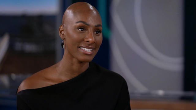 CBS News Philadelphia's Aziza Shuler shares her alopecia journey: "So ...