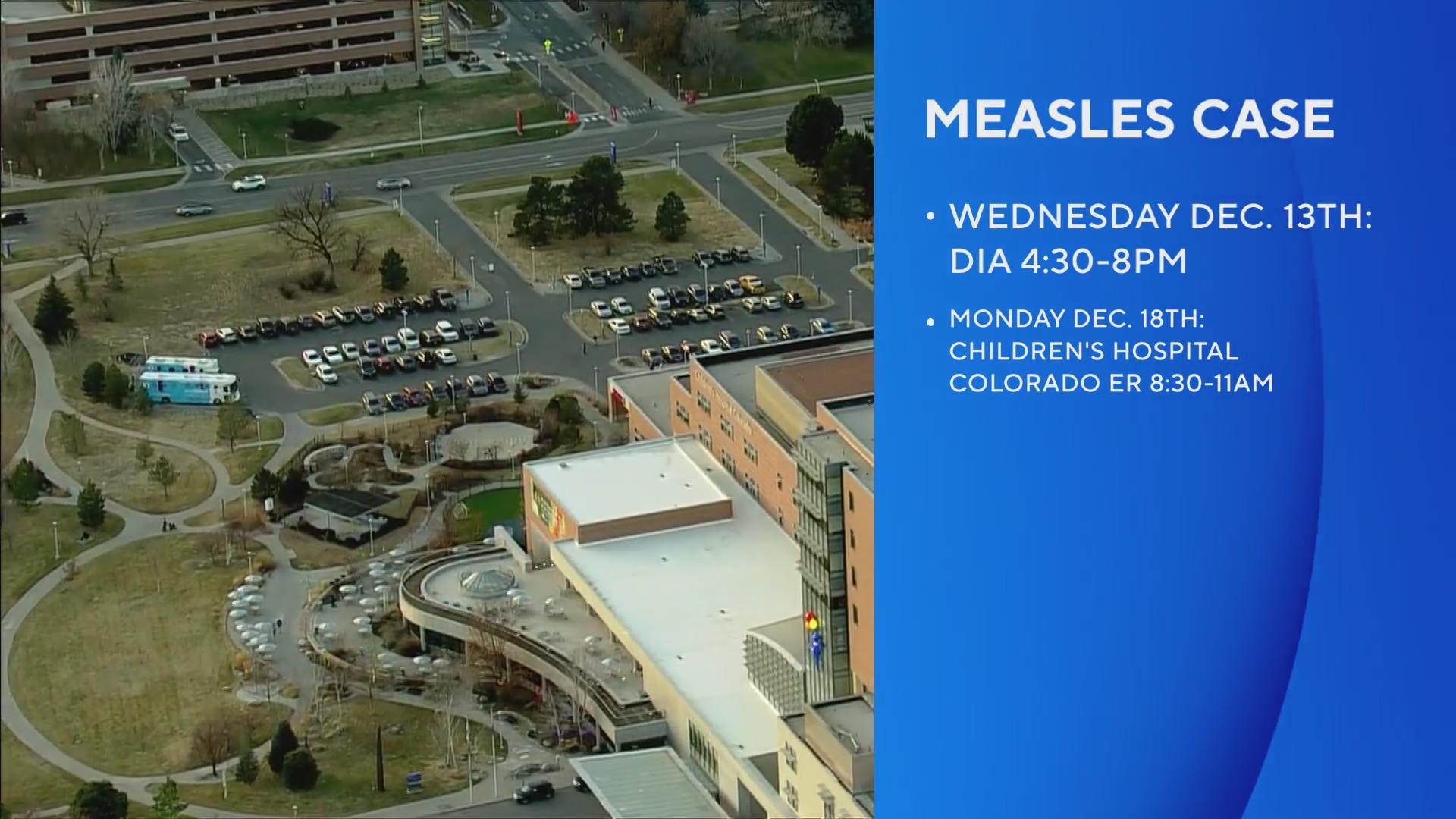 Measles case being treated in Colorado for first time in 4 years ...