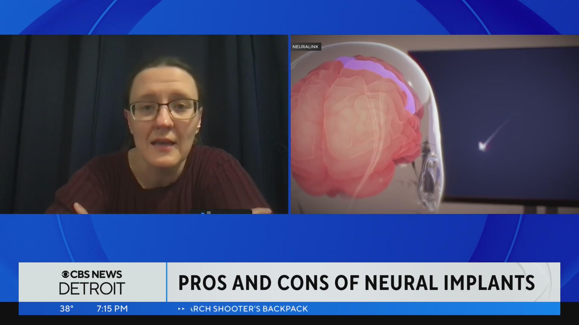 Elon Musk says first Neuralink patient can control a computer mouse ...