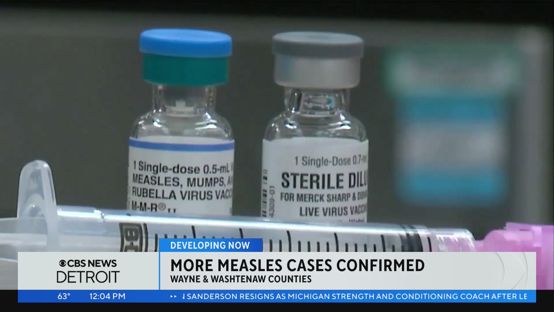 Measles cases in Michigan. Here's how to check your vaccination status ...