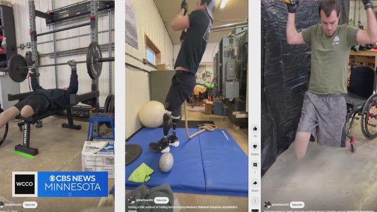 After farm accident, former Minnesota snocross racer walks again with ...