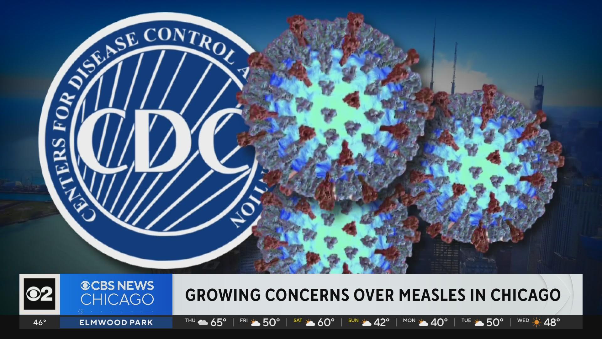 Chicago steps up vaccinations amid measles outbreak tied to migrant ...