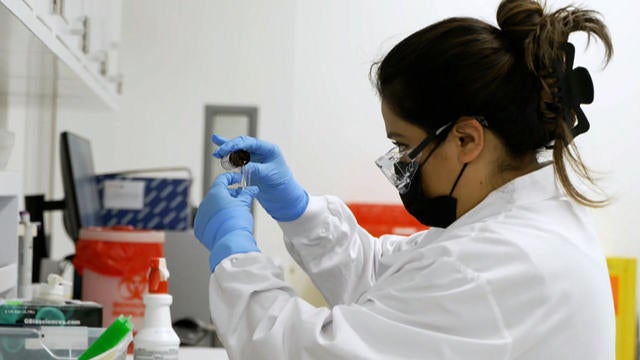 Blood test shows 83% accuracy for detecting colorectal cancer, study ...