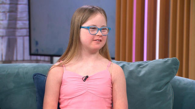 Viral ad campaign challenges perceptions for World Down Syndrome Day ...