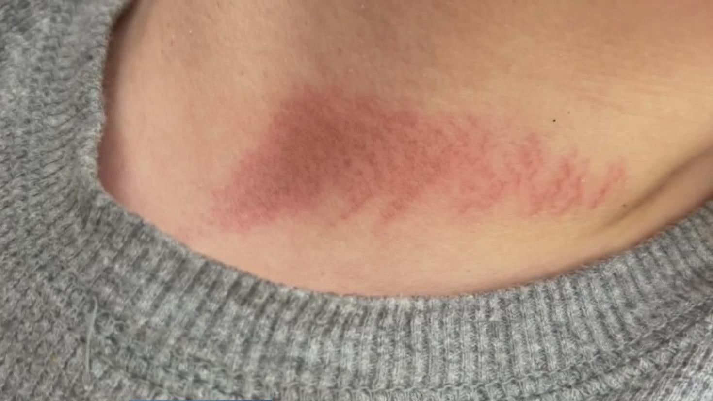 Mother says son, 5, choked with jump rope at Fairfield after-school ...