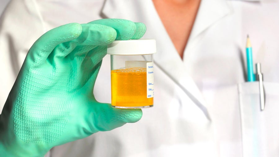 More employees are cheating on workplace drug tests. Here's how they do ...