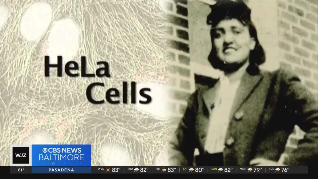 Henrietta Lacks family can proceed with lawsuit over use of HeLa cells ...