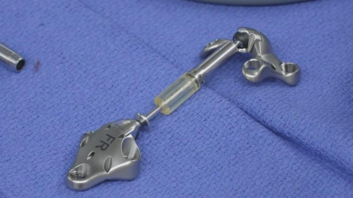 UC Davis Health one of first in U.S. to offer this cutting-edge tech ...