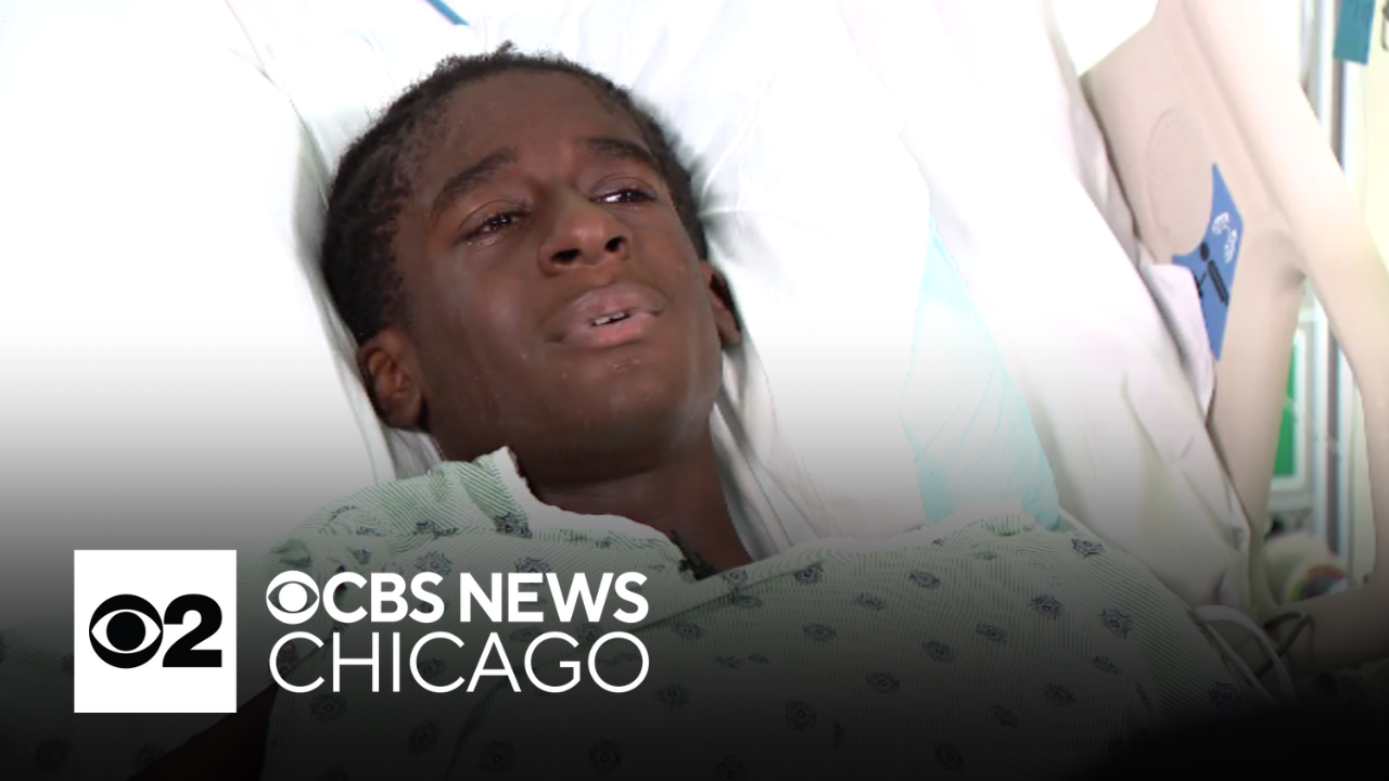 First-aid helps Chicago boy save his own life after shooting - CBS Chicago