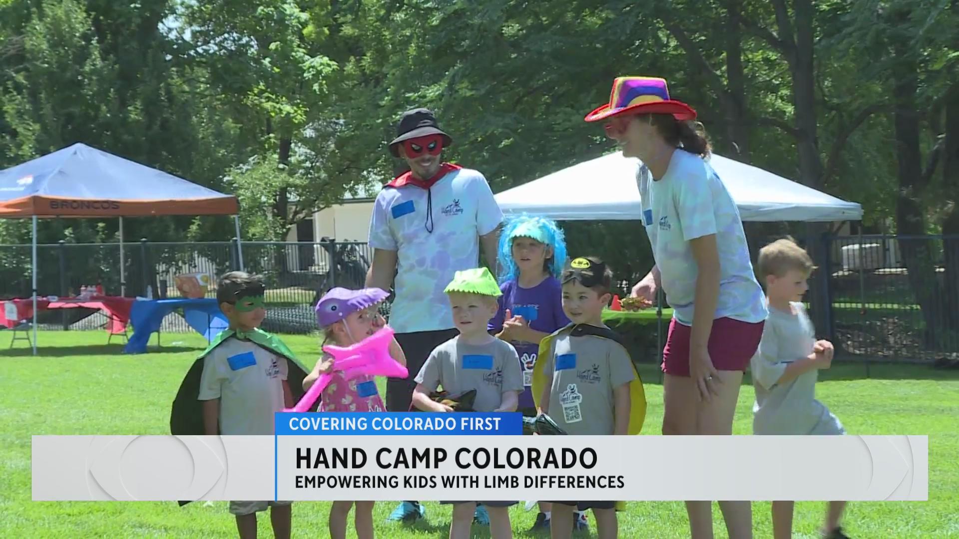 Hand Camp Colorado helps empower children with extremity differences ...
